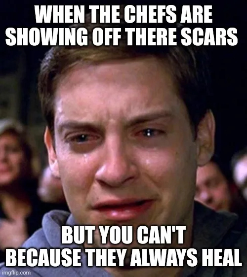 WHEN THE CHEFS ARE SHOWING OFF THERE SCARS; BUT YOU CAN'T BECAUSE THEY ...